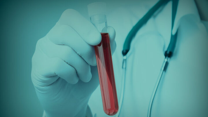 New OSHA Anti-retaliation Rule Causes Confusion and Concern - Holmes Murphy